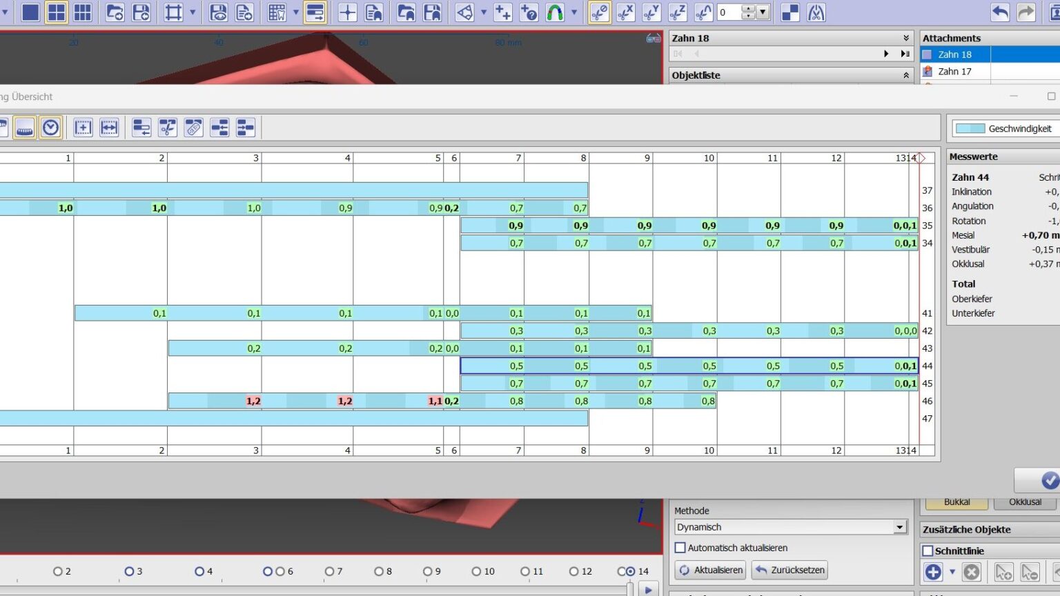 OnyxCeph³: Aligner Advanced - OSC-Andre Kranzusch